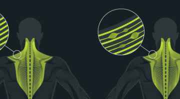 Triggerpunktmassage zur Linderung von Schmerzen